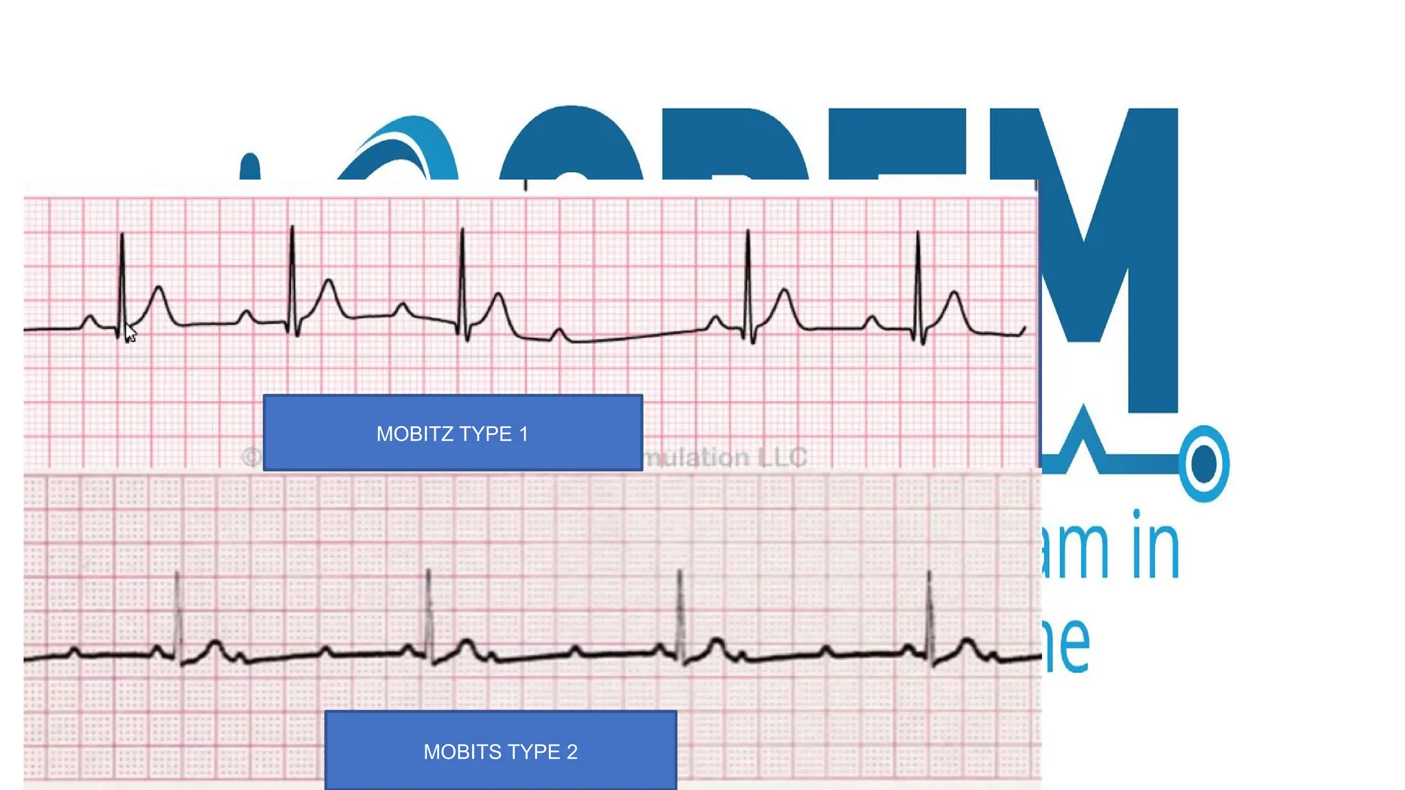 Electrocardiography Interpretation .pptx