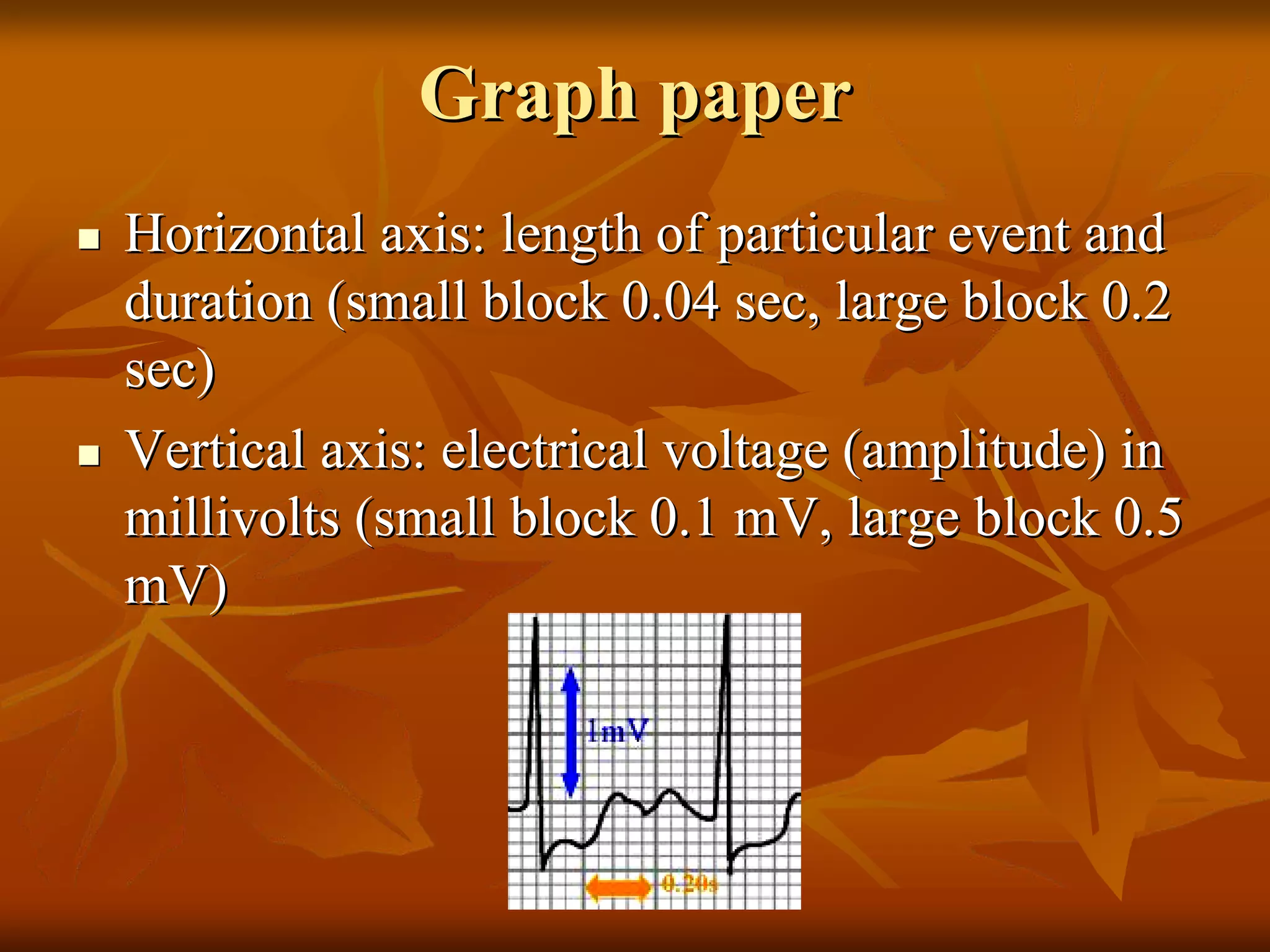 ECG Interpretation ECG Interpretation Basics & Quick Guide ( PDFDrive ).pdf