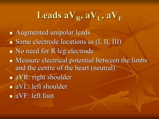 ECG Interpretation ECG Interpretation Basics & Quick Guide ( PDFDrive ).pdf