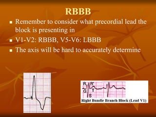 ECG Interpretation ECG Interpretation Basics & Quick Guide ( PDFDrive ).pdf