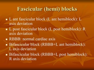 ECG Interpretation ECG Interpretation Basics & Quick Guide ( PDFDrive ).pdf