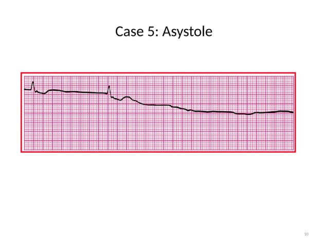ECG/EKG INTERPRETATION FOR HOUSE OFFICERS | PPTX