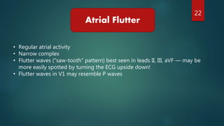 ECG interpretation in emergency settings | PPTX