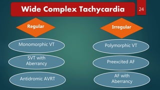 ECG interpretation in emergency settings | PPTX