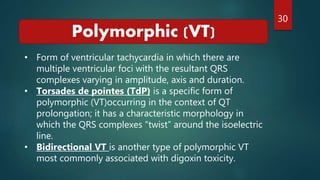 ECG interpretation in emergency settings | PPTX