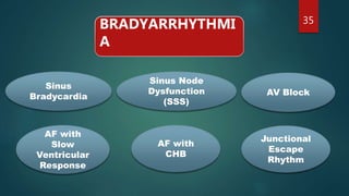 ECG interpretation in emergency settings | PPTX