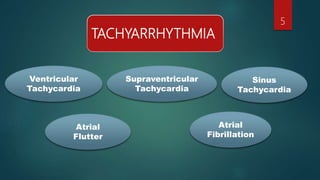 ECG interpretation in emergency settings | PPTX