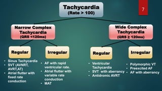 ECG interpretation in emergency settings | PPTX