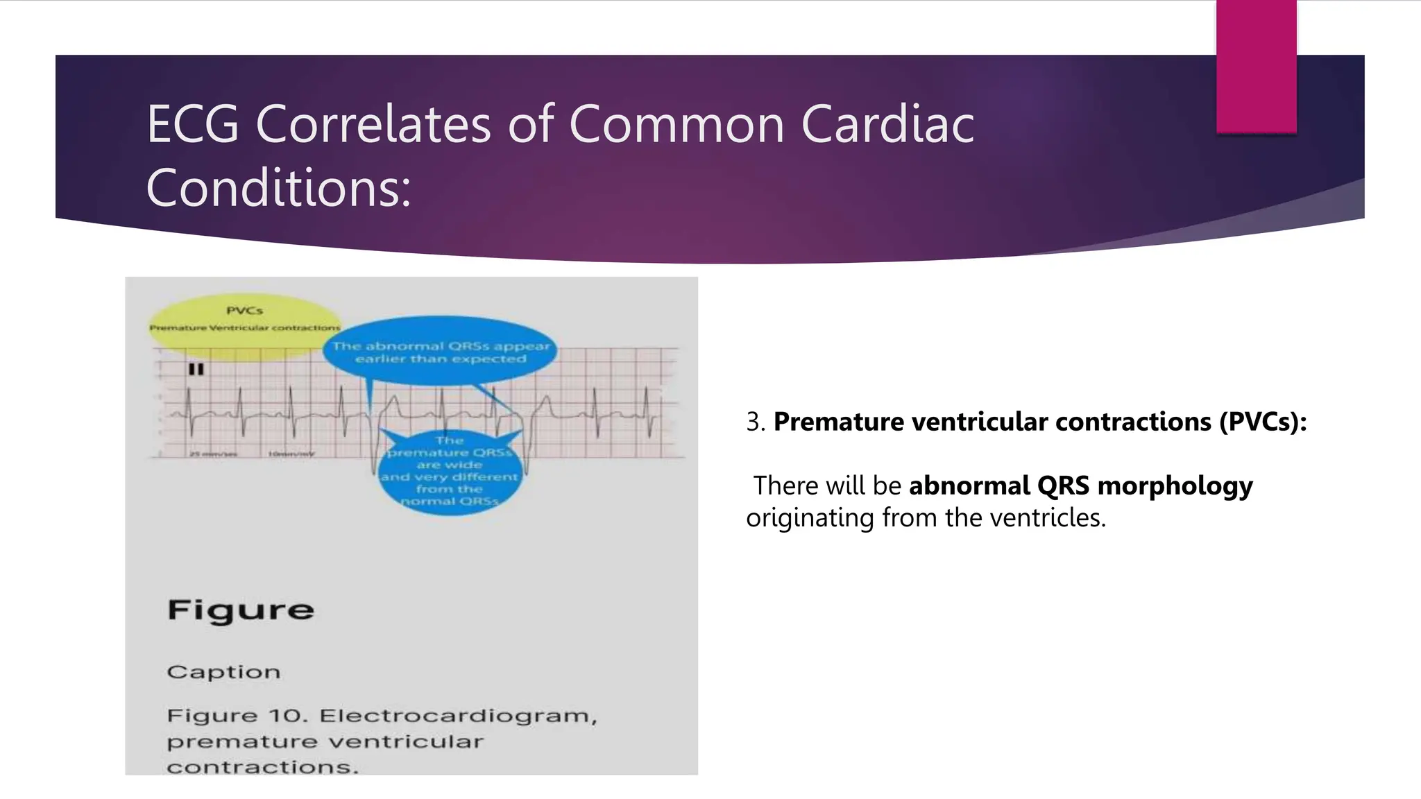 ECG interpretation: Echocardiography and Cardiac Catherization.pptx