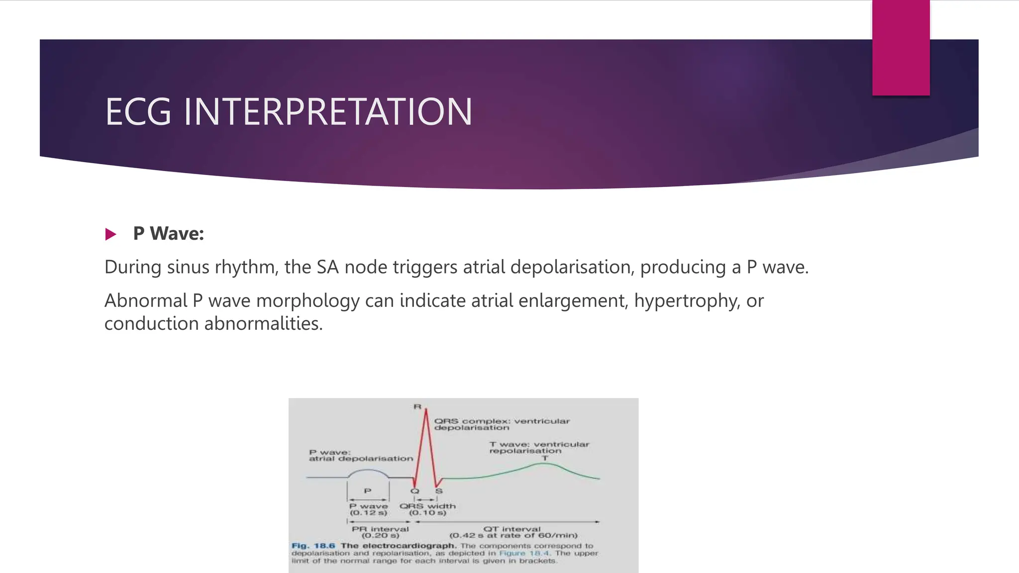ECG interpretation: Echocardiography and Cardiac Catherization.pptx