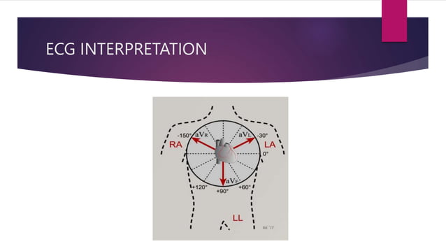 ECG interpretation: Echocardiography and Cardiac Catherization.pptx
