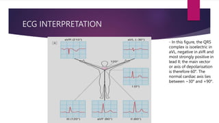 ECG interpretation: Echocardiography and Cardiac Catherization.pptx