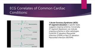 ECG interpretation: Echocardiography and Cardiac Catherization.pptx