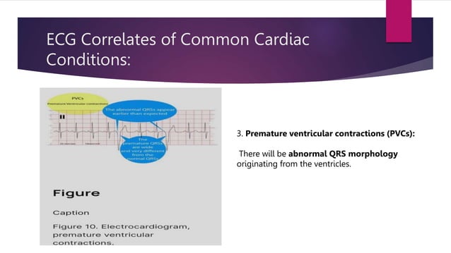 ECG interpretation: Echocardiography and Cardiac Catherization.pptx