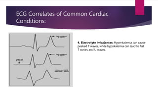 ECG interpretation: Echocardiography and Cardiac Catherization.pptx