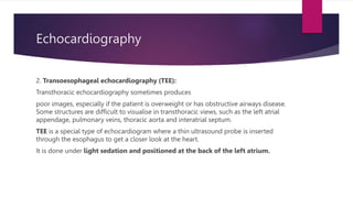 ECG interpretation: Echocardiography and Cardiac Catherization.pptx