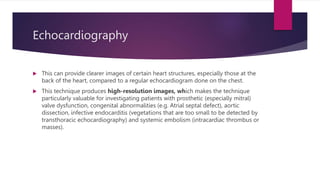 ECG interpretation: Echocardiography and Cardiac Catherization.pptx
