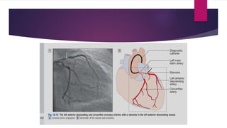ECG interpretation: Echocardiography and Cardiac Catherization.pptx