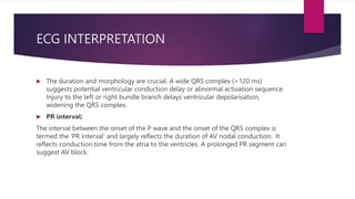 ECG interpretation: Echocardiography and Cardiac Catherization.pptx