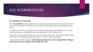 ECG interpretation: Echocardiography and Cardiac Catherization.pptx