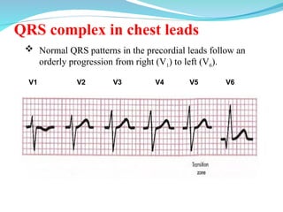 Electrocardiography (ECG) interpretation .ppt