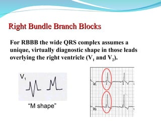 Electrocardiography (ECG) interpretation .ppt