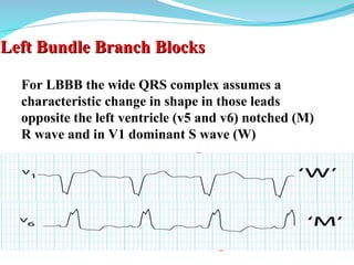 Electrocardiography (ECG) interpretation .ppt
