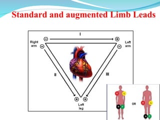Electrocardiography (ECG)interpretation .ppt