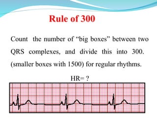 Electrocardiography (ECG)interpretation .ppt