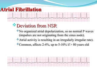 Electrocardiography (ECG)interpretation .ppt
