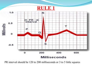 Electrocardiography (ECG)interpretation .ppt