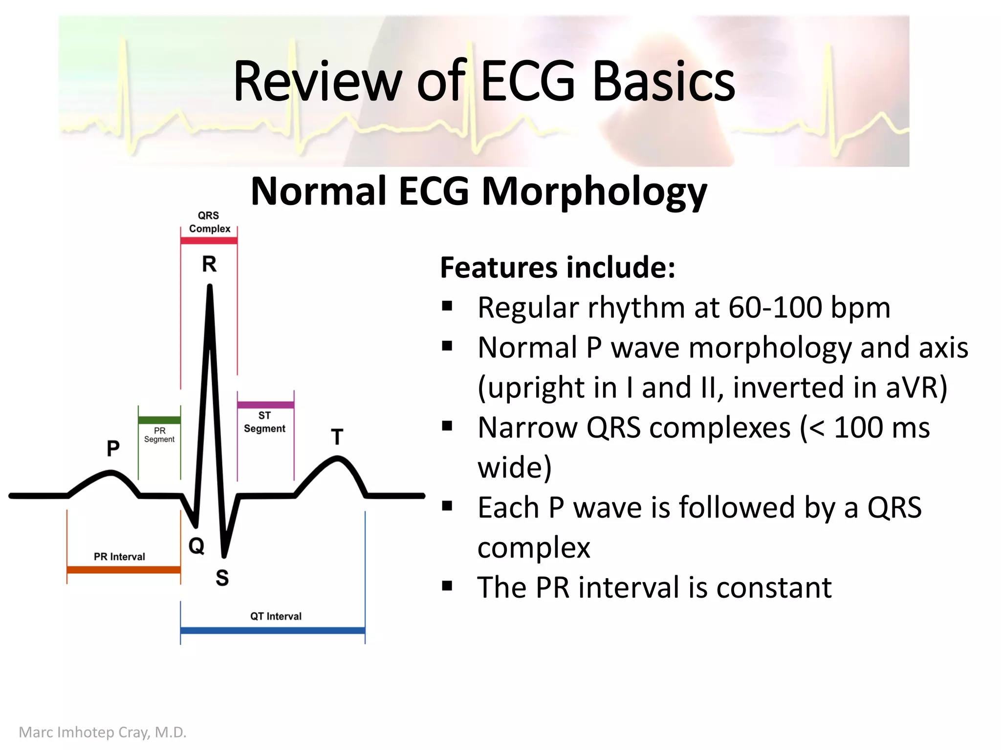 Electrocardiogram (ECG) Interpretation_Module 1 of 2 | PDF