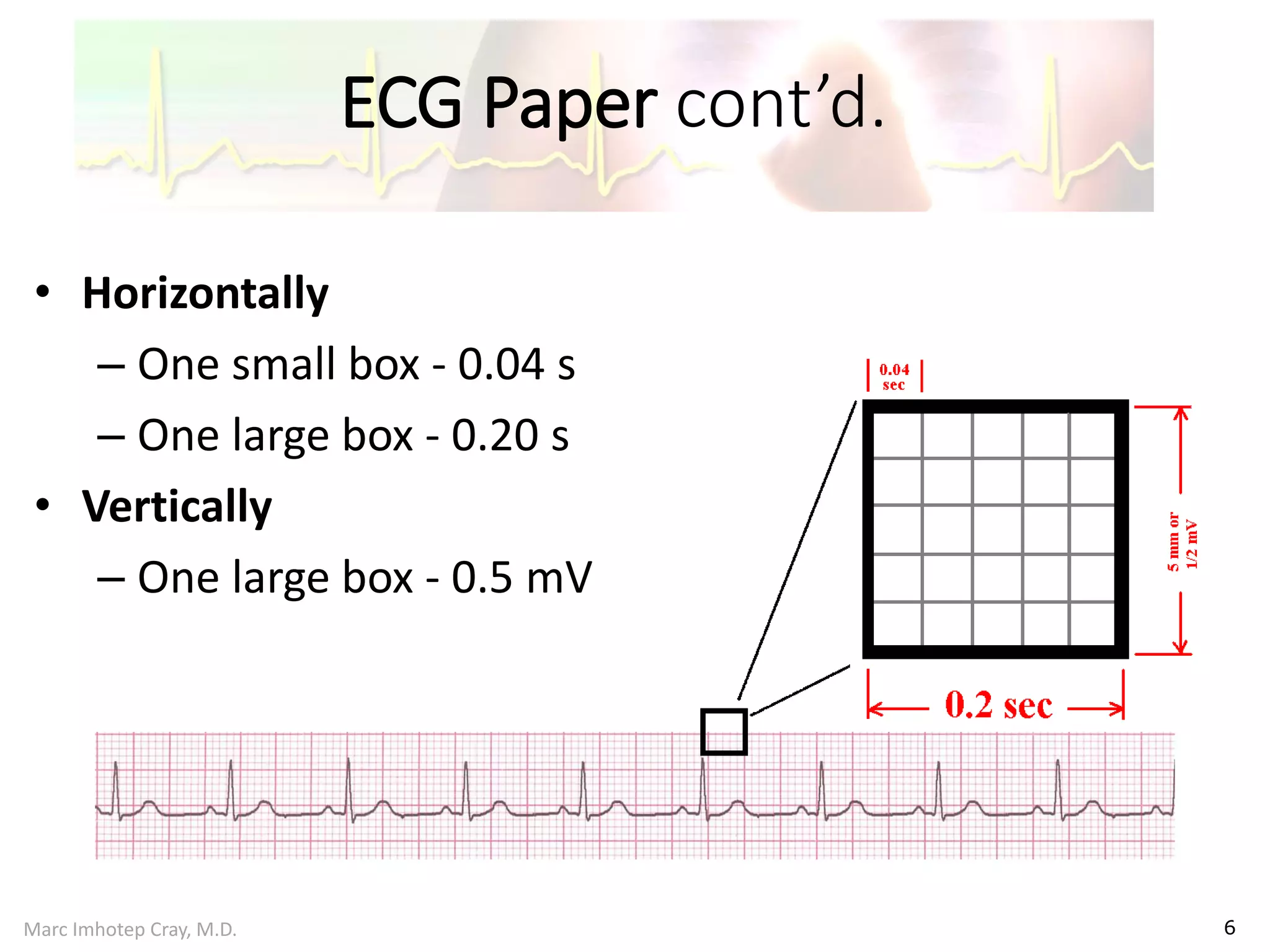 Electrocardiogram (ECG) Interpretation_Module 1 of 2 | PDF