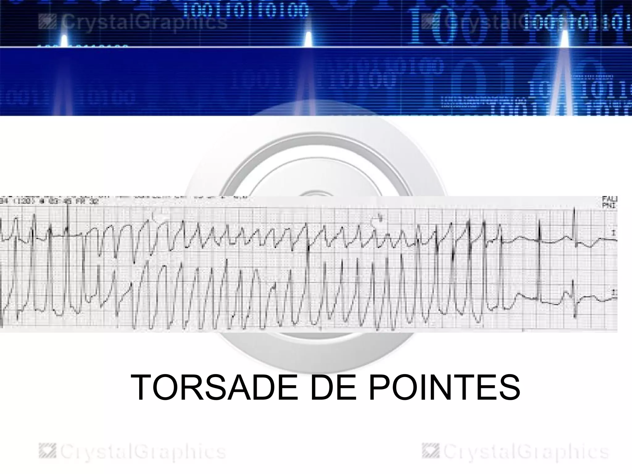 Electrocardiography | PPT