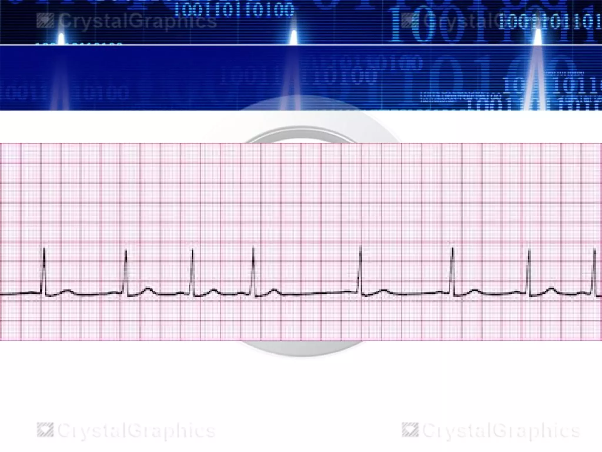 Electrocardiography | PPT