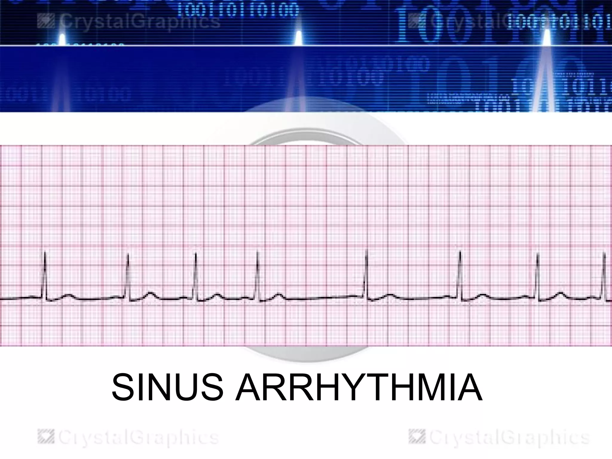 Electrocardiography | PPT