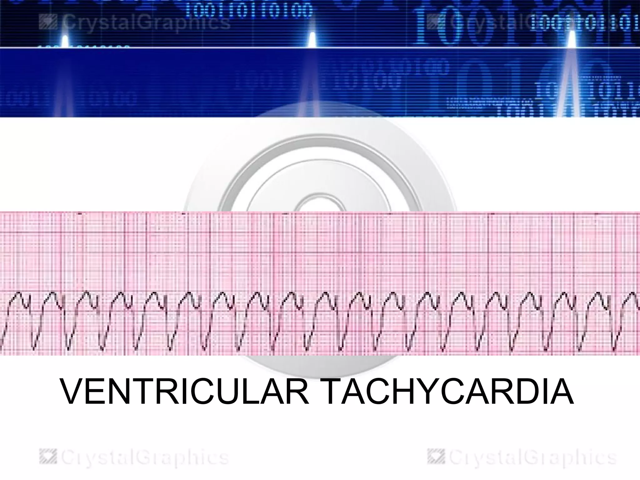 Electrocardiography | PPT