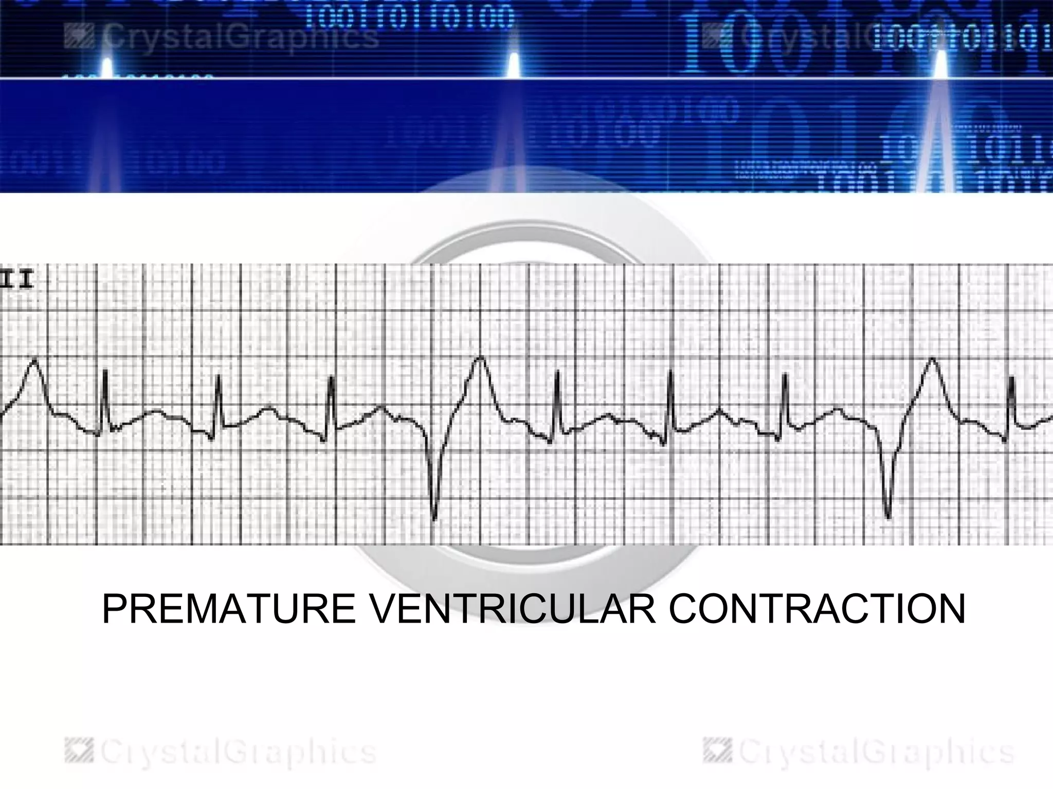 Electrocardiography | PPT