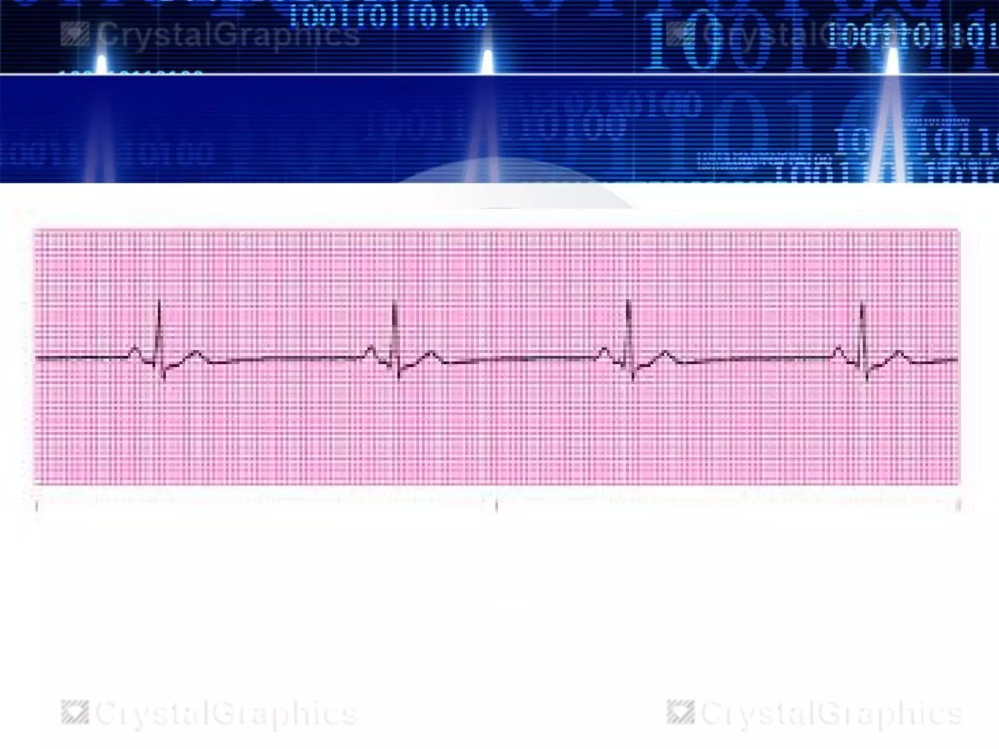 Electrocardiography | PPT
