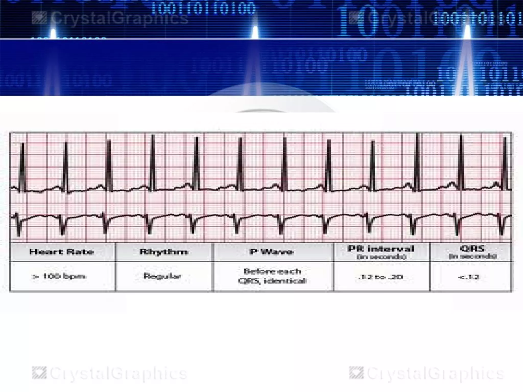 Electrocardiography | PPT