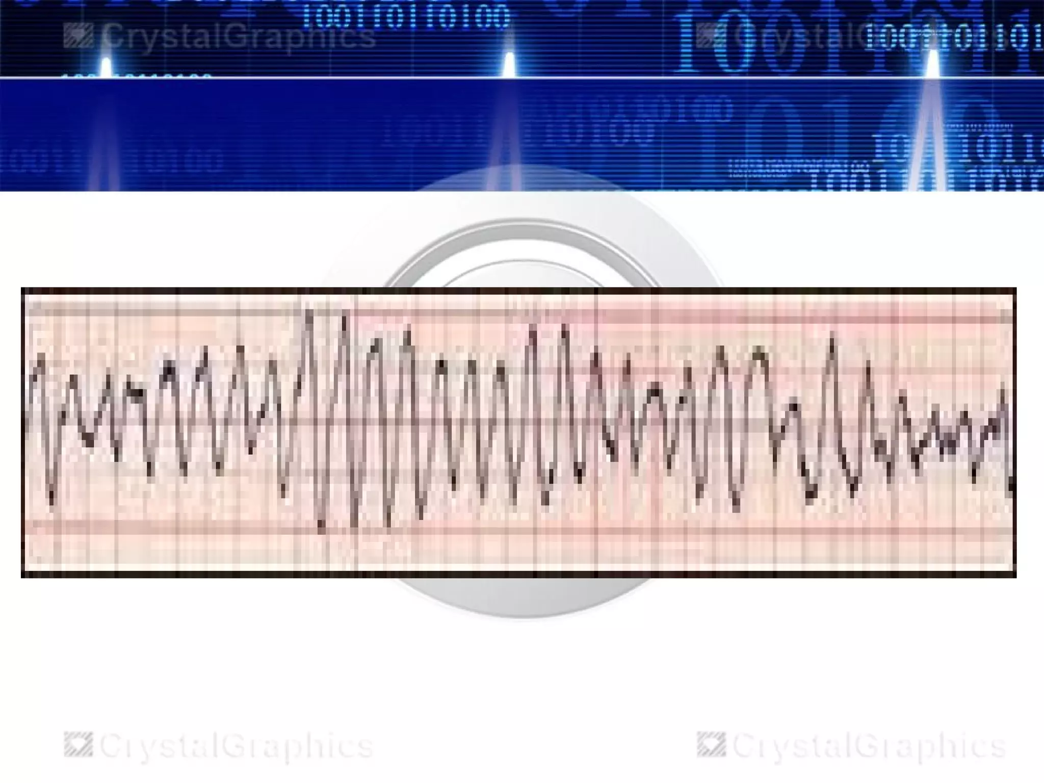 Electrocardiography | PPT