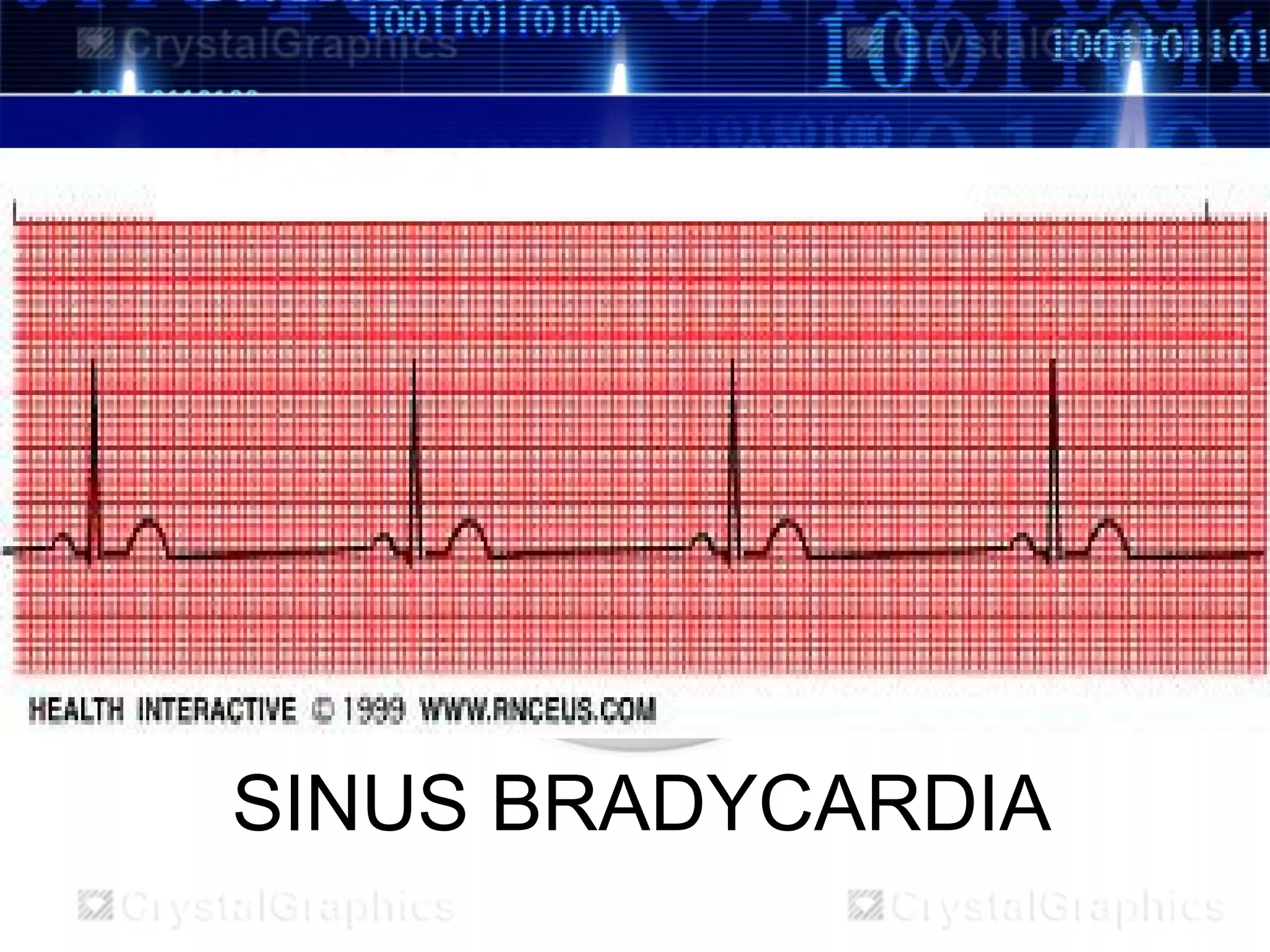 Electrocardiography | PPT