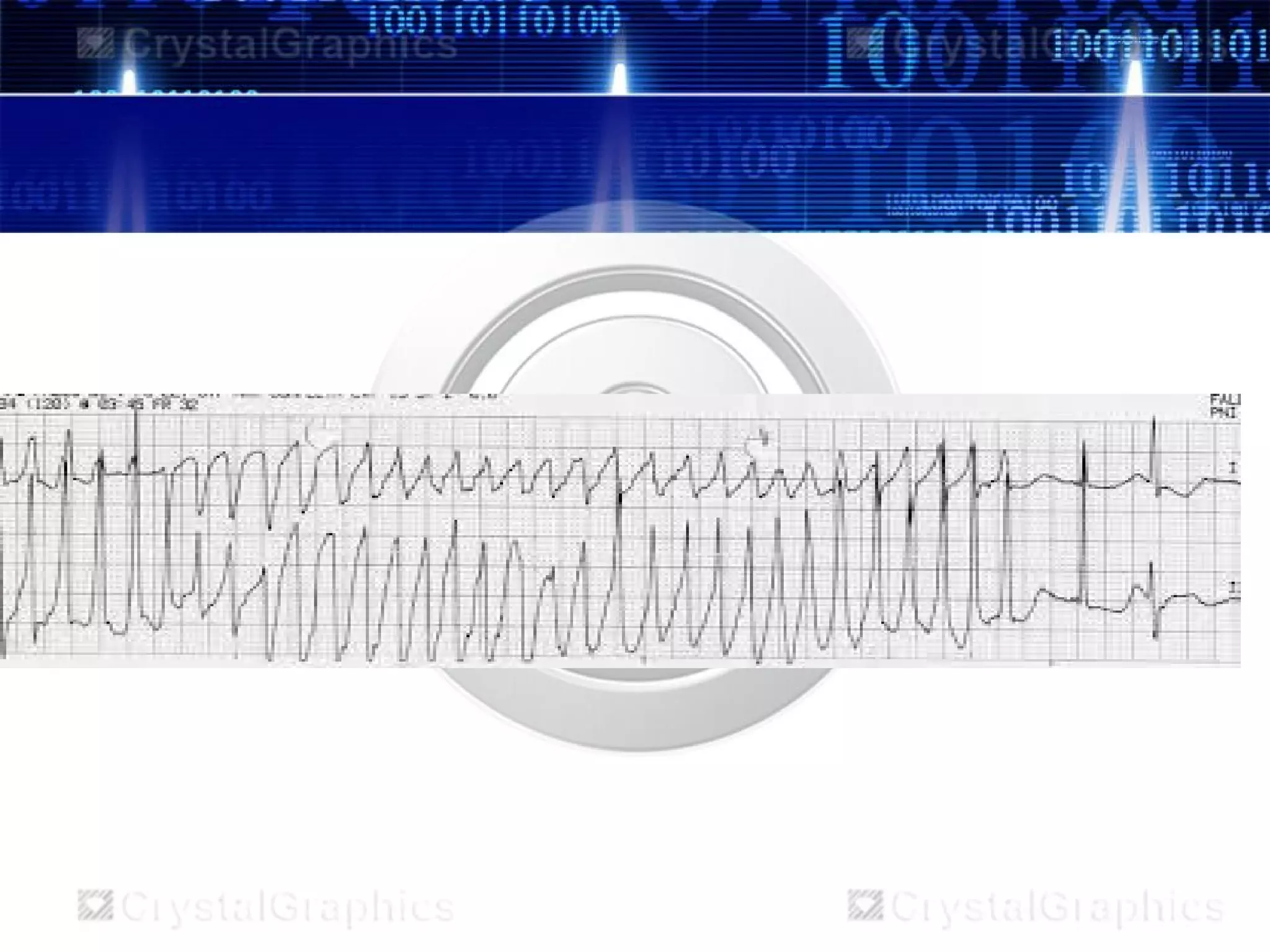 Electrocardiography | PPT