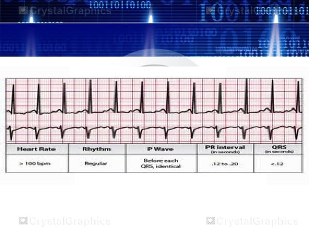 Electrocardiography | PPT