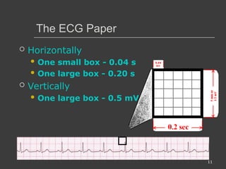 ECG interpretations rhythm Dr Sajid Noor.ppt