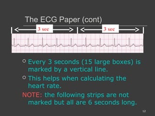ECG interpretations rhythm Dr Sajid Noor.ppt