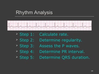 ECG interpretations rhythm Dr Sajid Noor.ppt