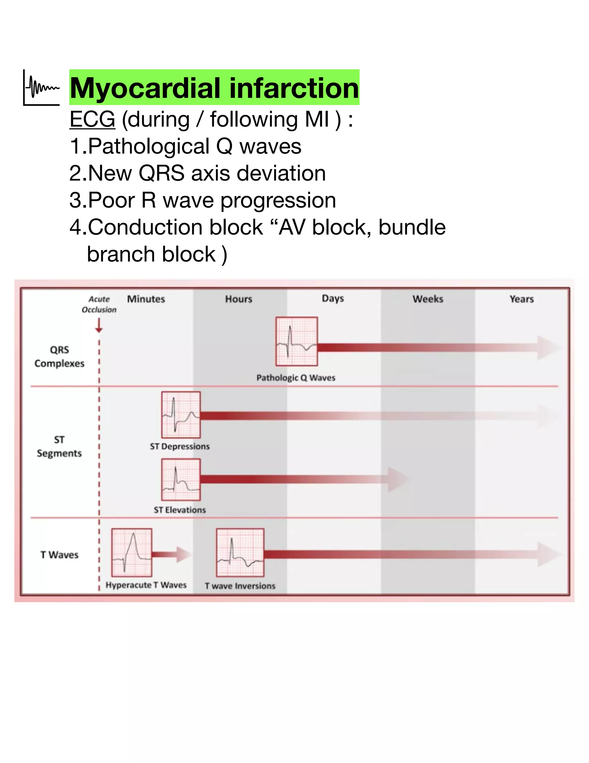 ECG interpret notes.pdf