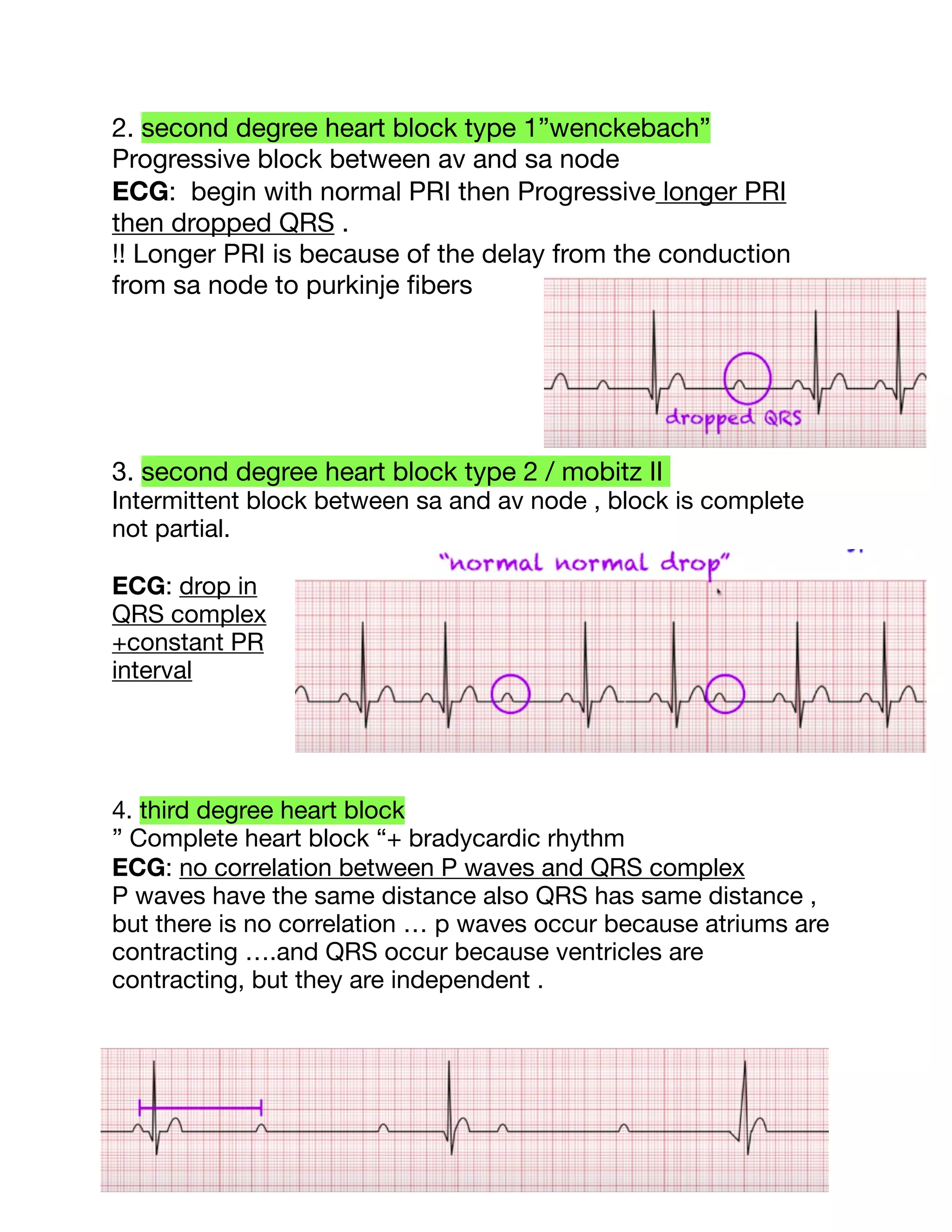 ECG interpret notes.pdf