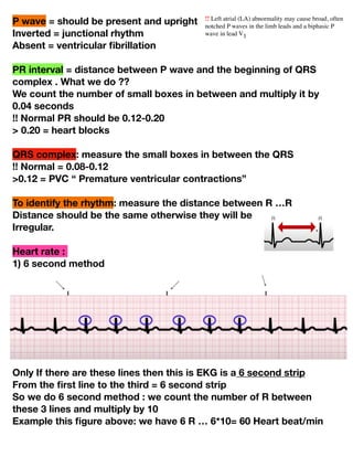 ECG interpret notes.pdf